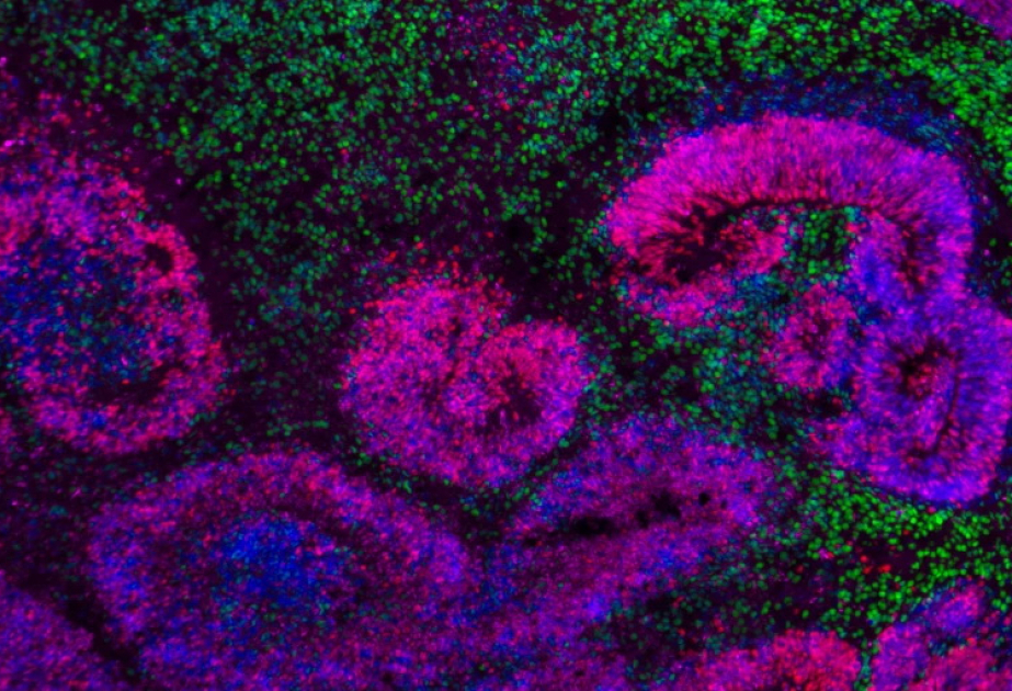 Scientists were the first - They compiled a brain atlas | Modern.az